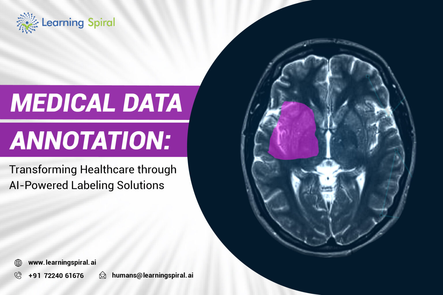 Medical Data Annotation: Transforming Healthcare with AI